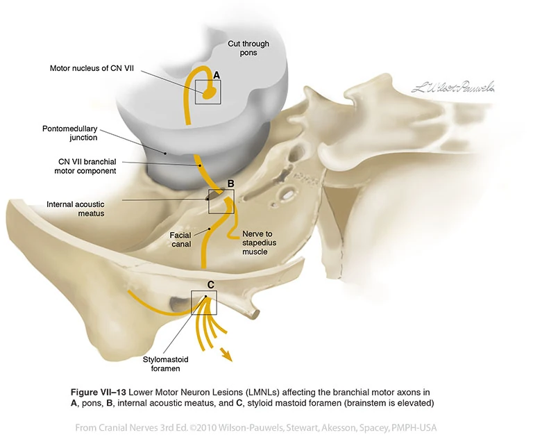 Intracranial cavity (extra axial): Posterior cranial fossa:Internal ...