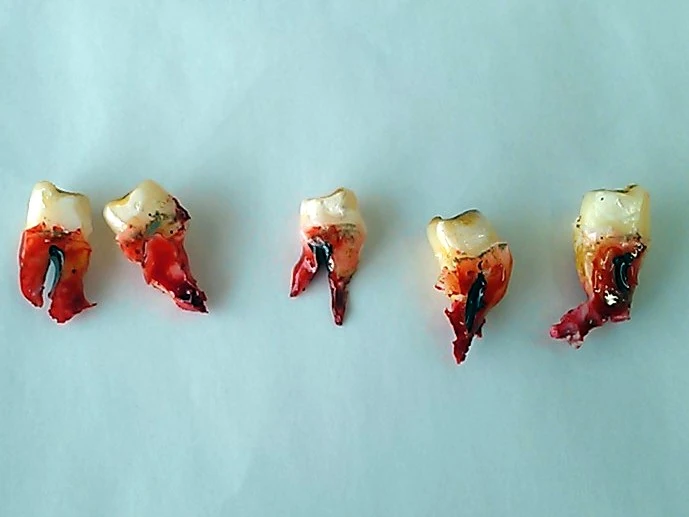 Image - Cropped-bloody-teeth.jpg | Spinpasta Wiki | FANDOM powered by Wikia